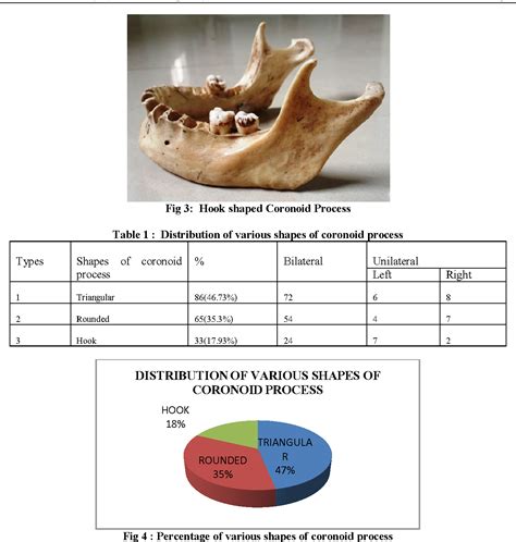 Coronoid Process