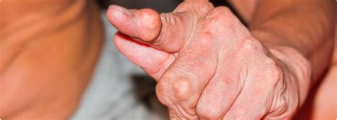 Gicht Ablauf Kosten And Erfahrungen