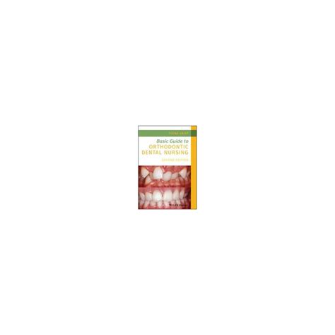 Basic Guide To Orthodontic Dental Nursing