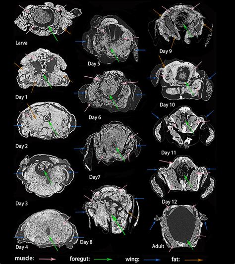 Chrysopa Pallens Cross Sections From Micro Computed Tomography Of