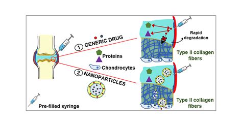 Injectable Drug Delivery Systems For Osteoarthritis And Rheumatoid Arthritis Acs Nano