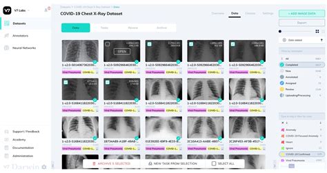 V7 Labs Automates Image Annotation For Deep Learning Nvidia Blog V7 Labs Automates Image Annotation For Deep Learning Nvidia Blog