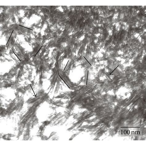 Nanostructure Of The Bone As Viewed By Electron Microscope 5 Taken