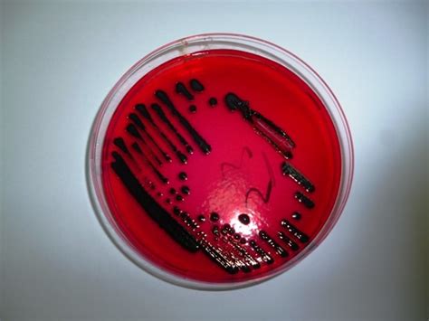 Citrobacter Freundii On Xld Agar Elmicrobiologist Facebook