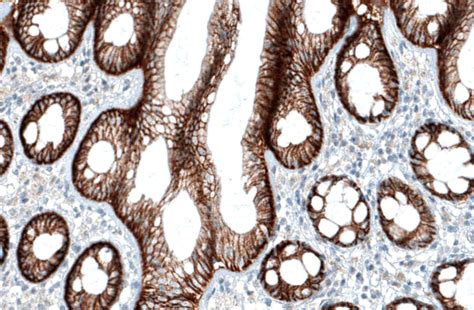 Integrin Antibodies From Atlas Antibodies