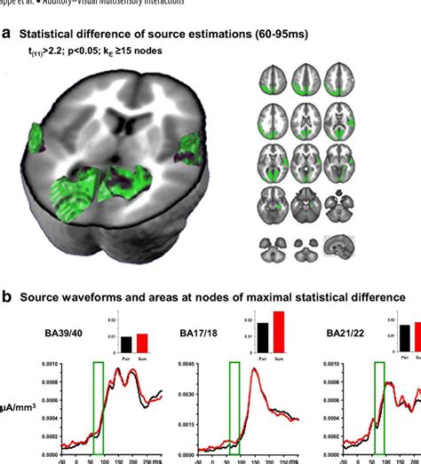 Figure 4 Auditory Visual Multisensory Interactions In
