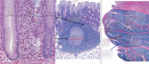Diffuse Lymphatic Tissue Lecture 20 Pt 2 Diagram Quizlet Diffuse Lymphatic Tissue Lecture 20 Pt 2 Diagram Quizlet