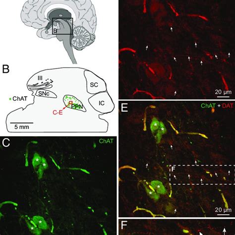Simple Two Layer Neural Network With Two Inputs Two Outputs And Four