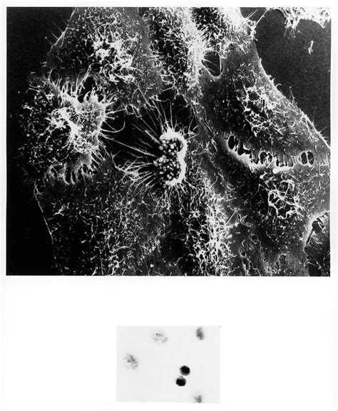 Adenoviridae Maps Image Picryl Public Domain Media Search Engine