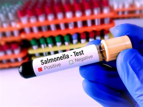 Premium Photo Blood Sample For Salmonella Bacteria Test Typhoid Fever