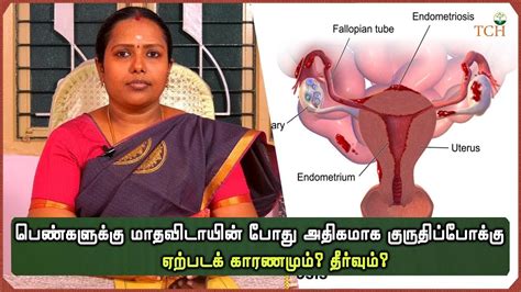 பணகளகக மதவடயன பத அதகமன கரதபபகக ஏறபட கரணமம தரவம YouTube