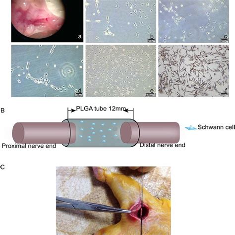 Evaluations For Nerve Regeneration And Recovery Of Sciatic Nerve
