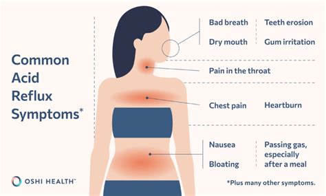 Acid Reflux And Gerd 101 Symptoms Causes And Treatments Oshi Health