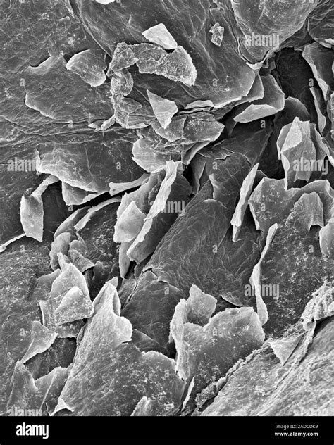 Human Skin Epidermis Scanning Electron Micrograph Sem Outer