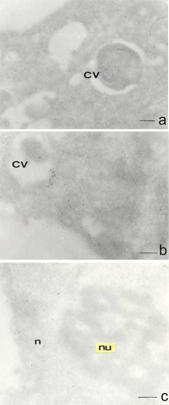 Em Immunogold Labelling Of Blv Regulatory Proteins Tax In Cytoplasmic