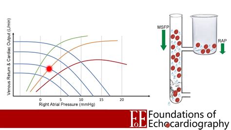 Bse Level 1 Volume Assessment