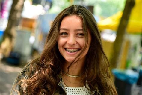 Braces Qanda 10 Must Ask Questions Before Treatment