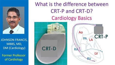 what is the difference between crt p and crt d cardiology basics youtube