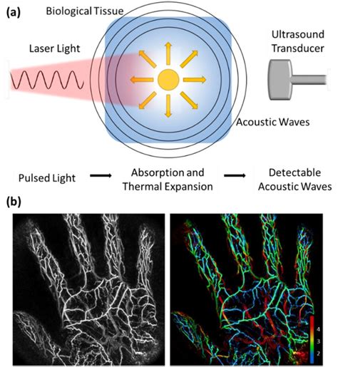 A Schematic Of Photoacoustic Imaging With Two Example Images Matsumoto