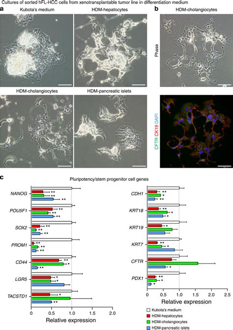 Differentiation Assay Of Fl Hcc Cells From Transplantable Tumour Line