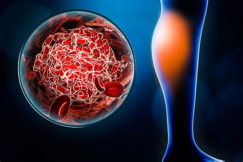 Harvard Health Ad Watch A Blood Thinner Winner Harvard Health