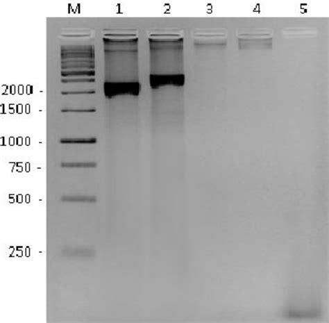 Amplification Of Dna By Using 18s Rdna Conserved Primers Ma1 Ma2 M