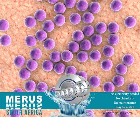 Merus 💧 Enterococcus The Waterborne Survivor Hiding In Your Pipes 💧 Did You Know Even In