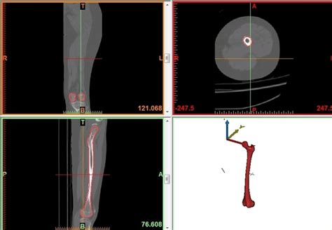 Dicom To 3d Download Free 3d Model By Goku1990 Cad Crowd