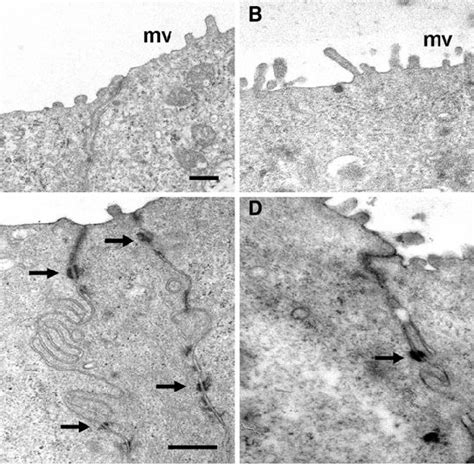 Teer Measurement Of Ipec 1 And Ipec J2 Cells Cultured On Conventional