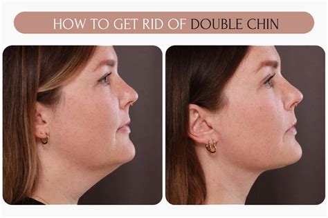 How To Get Rid Of Double Chin Fast And Easy