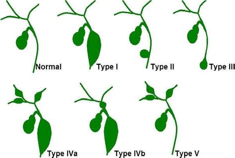 Todani Classification Of Target Ini Cet Md Ms