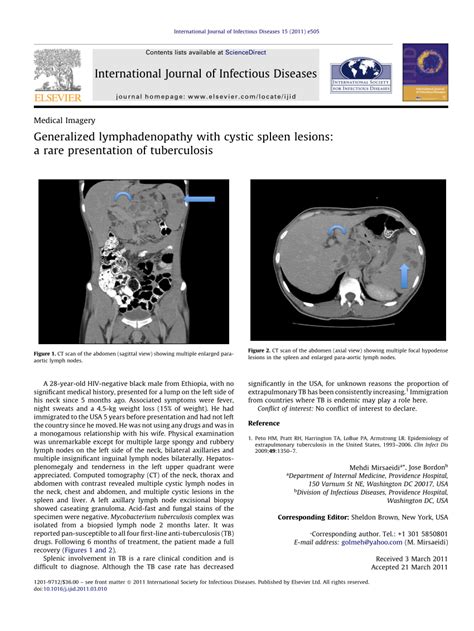 Pdf Generalized Lymphadenopathy With Cystic Spleen Lesions A Rare