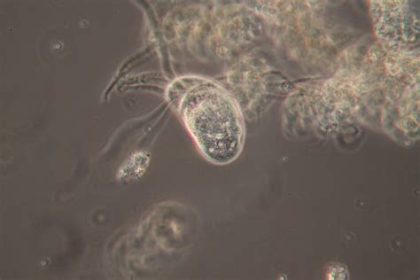 Chilodonella Type Feralco Waterlab