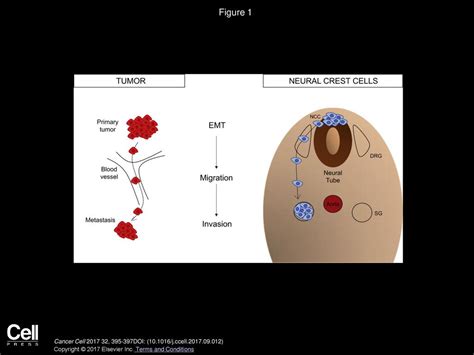 Neuroblastoma Metastases Leveraging The Avian Neural Crest Ppt Download