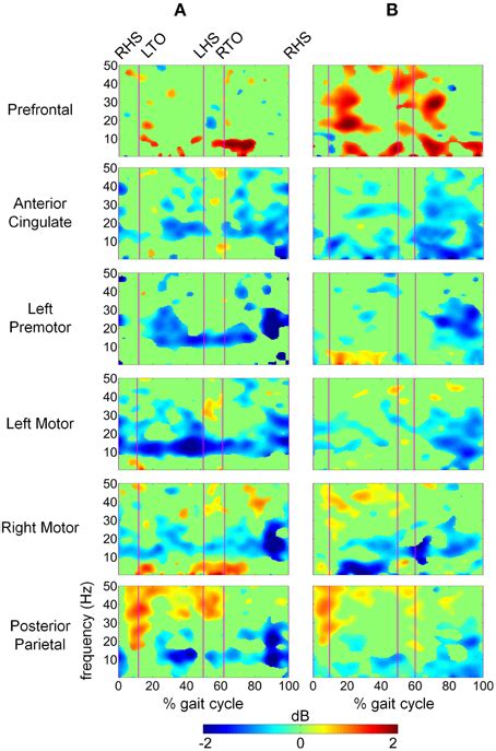 Time Frequency Spectrograms Showing The Power Differences Between