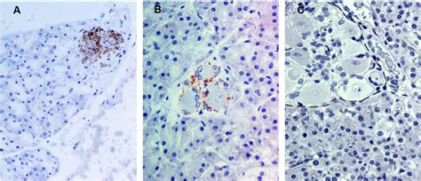 Immunohistochemical Detection Of Prp Sc In Pancreas Using L42 Prp Download Scientific Diagram