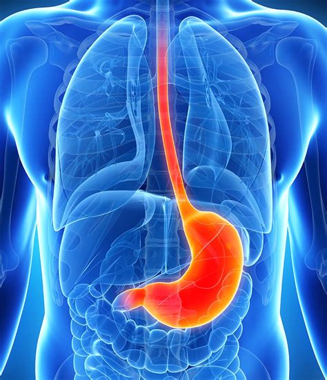 Peptic Ulcer Diagnosis And Treatment Services In India Desai Surgical