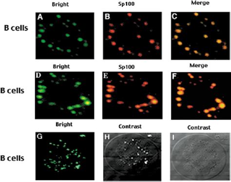 Bright Colocalizes With Sp100 Within Pml Nbs Vector Constructions And