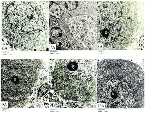 Transmission Electron Micrographs Of The Cerebellar Cortex Of The