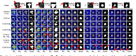 Figure 1 From Lung Nodule Segmentation And Uncertain Region Prediction