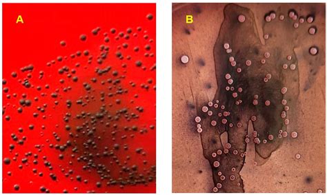 Molecular Detection Of Virulence Genes Biofilm Formation And Antibiotic Resistance In