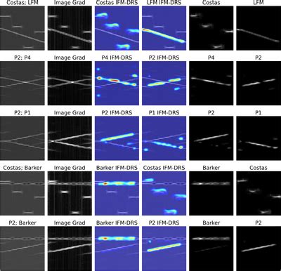 Hybrid Radar Signals Localization And Separation Through Interpretable Download Scientific