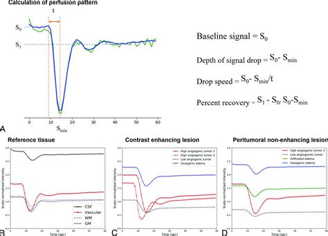 Deep Learning Of Timesignal Intensity Curves From Dynamic