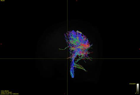 Strange Error When Using Tcknormalise Tractography Mrtrix3 Community