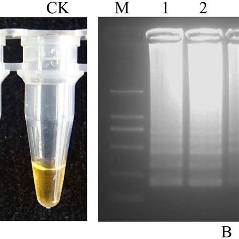 Loop Mediated Isothermal Amplification Of Dna Lamp For Detection Of