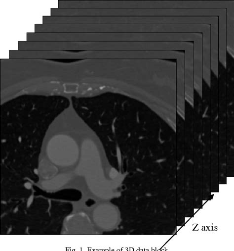 Figure 1 From Pattern Matching Algorithms In Preparation Of A 3d Heart