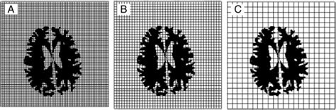 example of fd estimation for cerebral white matter using box counting