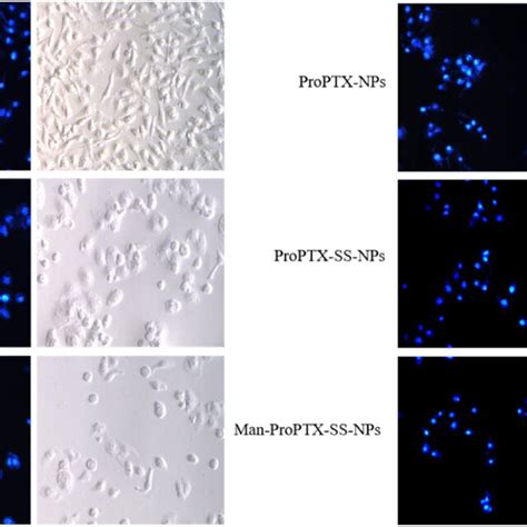 The Particle Size And Potential Of Blank‐pp‐nps A Proptx‐nps