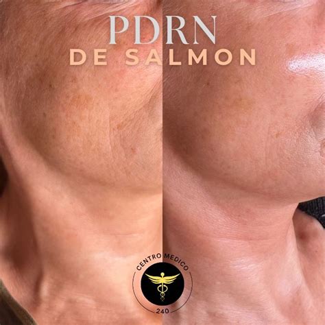 Rolando La Combinación Perfecta Para Un Rejuvenecimiento Facial 😌