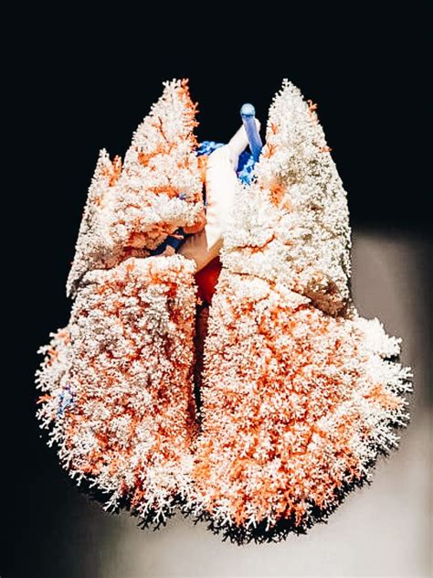 The Bodies Exhibition In Las Vegas Nevada